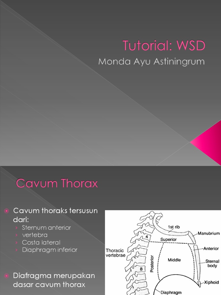 Penanganan Pneumothorax dengan WSD | PDF