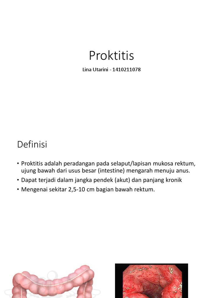 Proktitis | PDF | Sains & Matematika