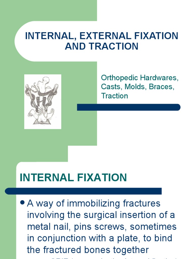 Internal, External Fixation and Traction