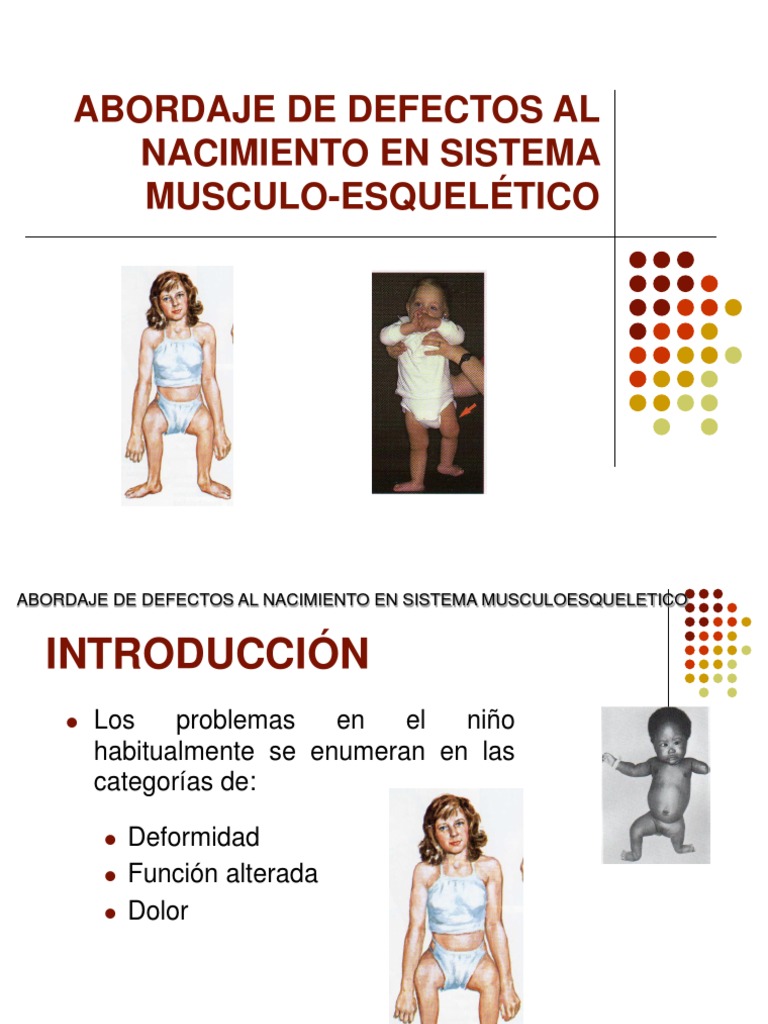 Abordaje de Defectos Al Nacimiento en Sistema Musculoesquelético | PDF ...