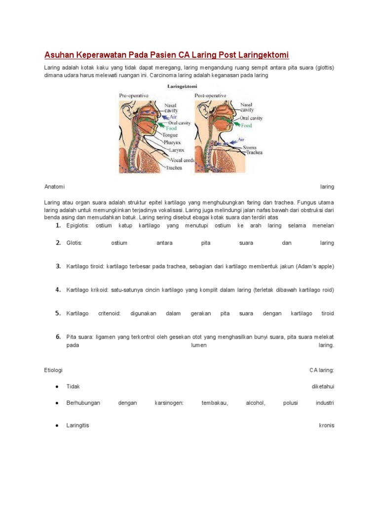 Asuhan Keperawatan Pada Pasien CA Laring Post Laringektomi | PDF
