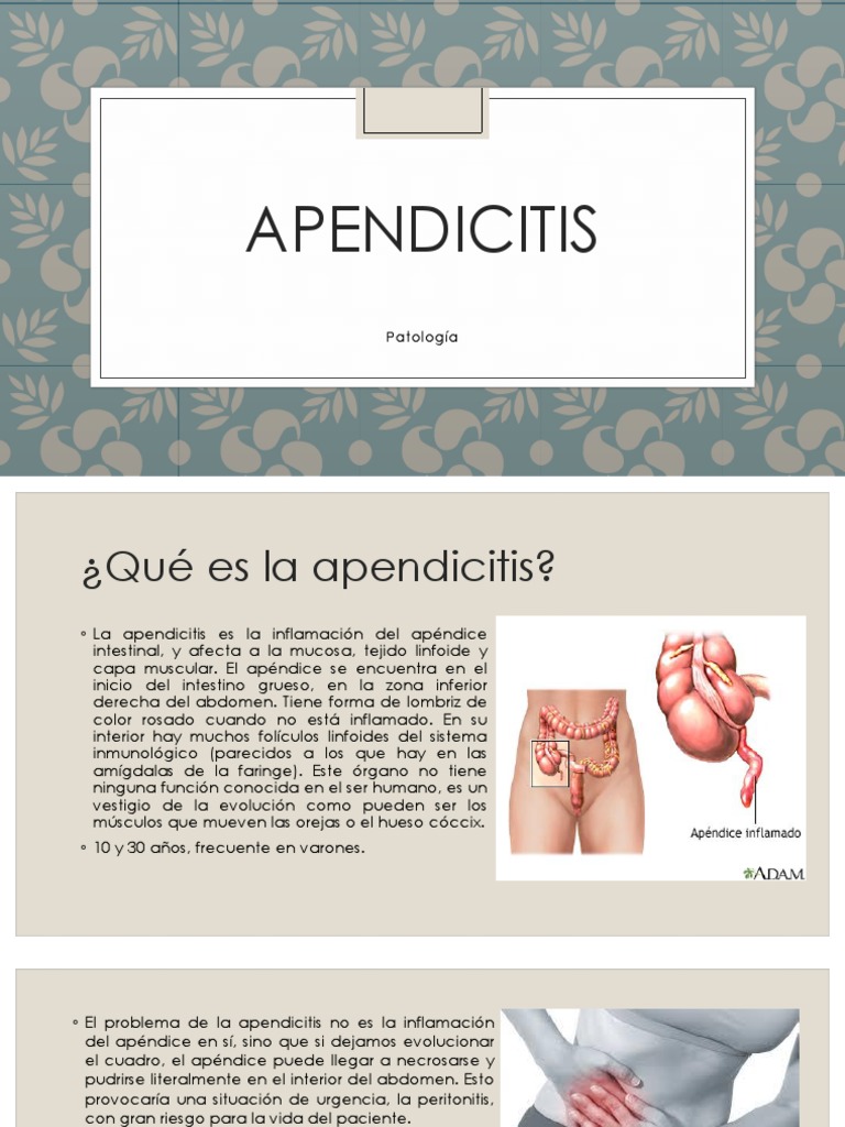 Apendicitis | Gastroenterología | Especialidades Medicas
