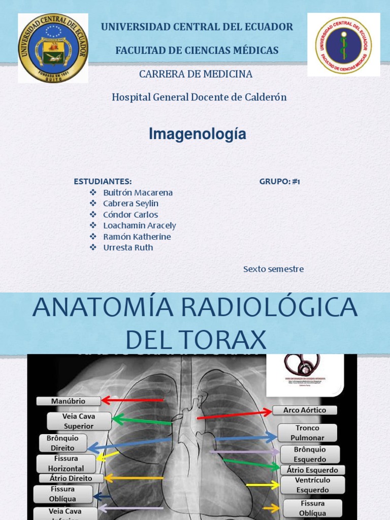 RX de Torax | PDF | Tuberculosis | Pulmón