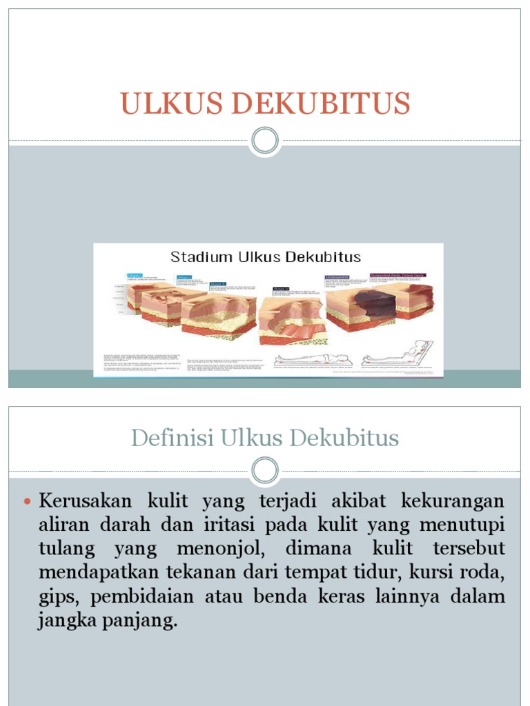 Ulkus Dekubitus | PDF