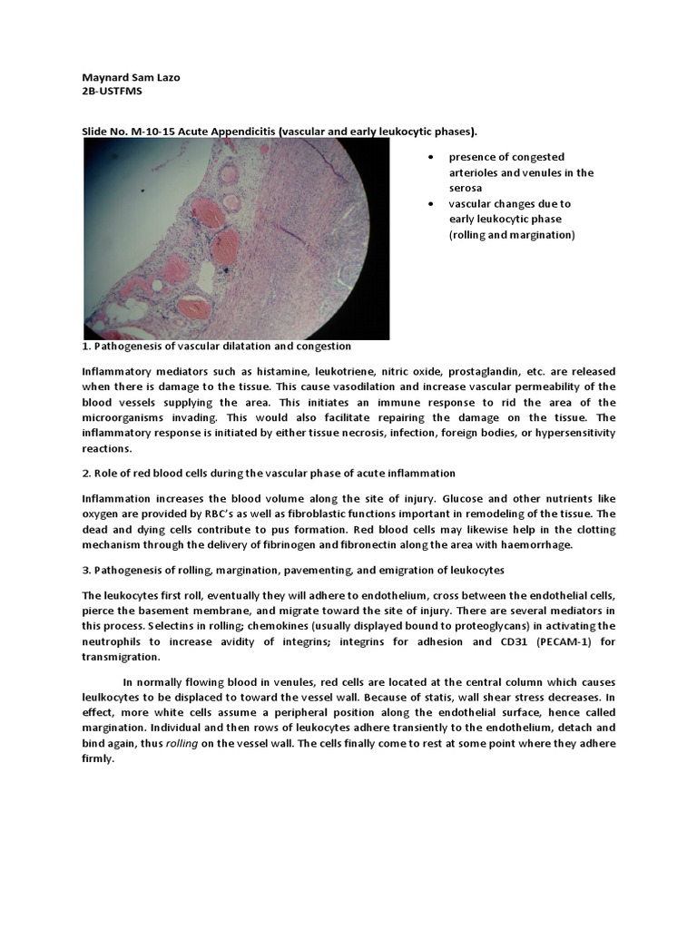 Maynard Sam Lazo 2B-Ustfms | PDF | Macrophage | Wound Healing
