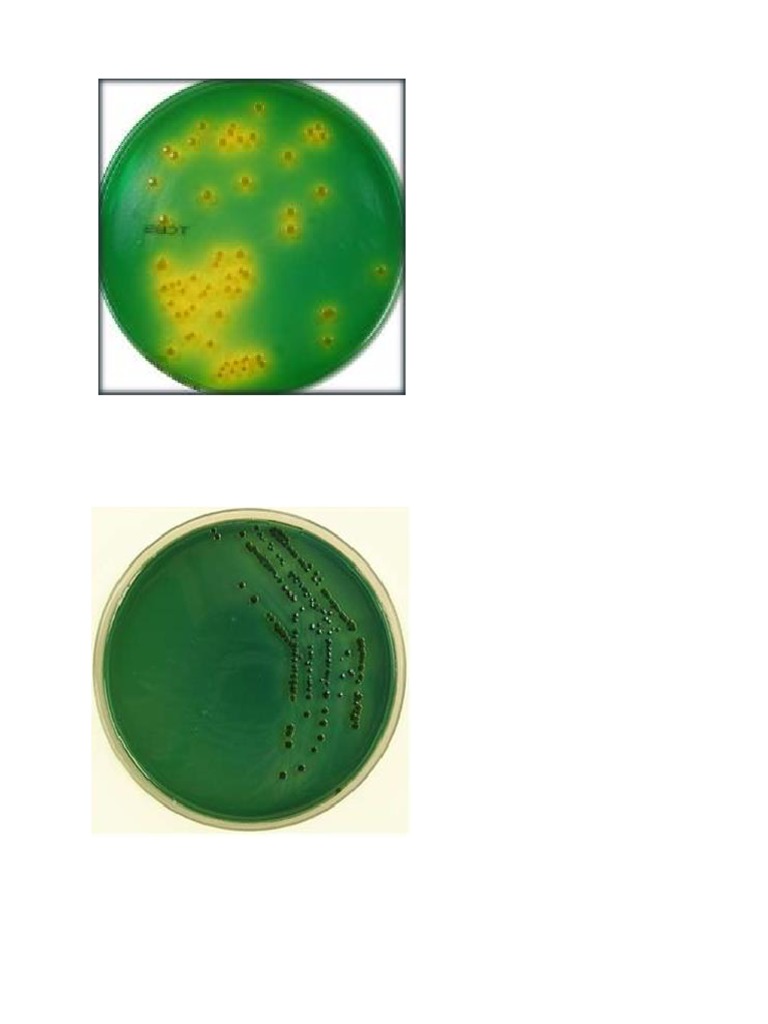 Bile salt string test identification of Vibrio cholerae | PDF ...