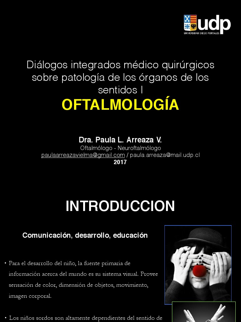 Pupilas Discoricas y Signo de Stellwag | PDF | Ojo humano | Glaucoma