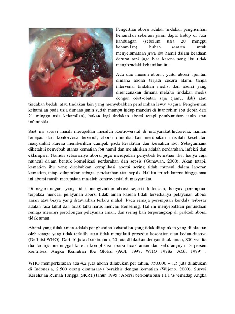 Aborsi | PDF