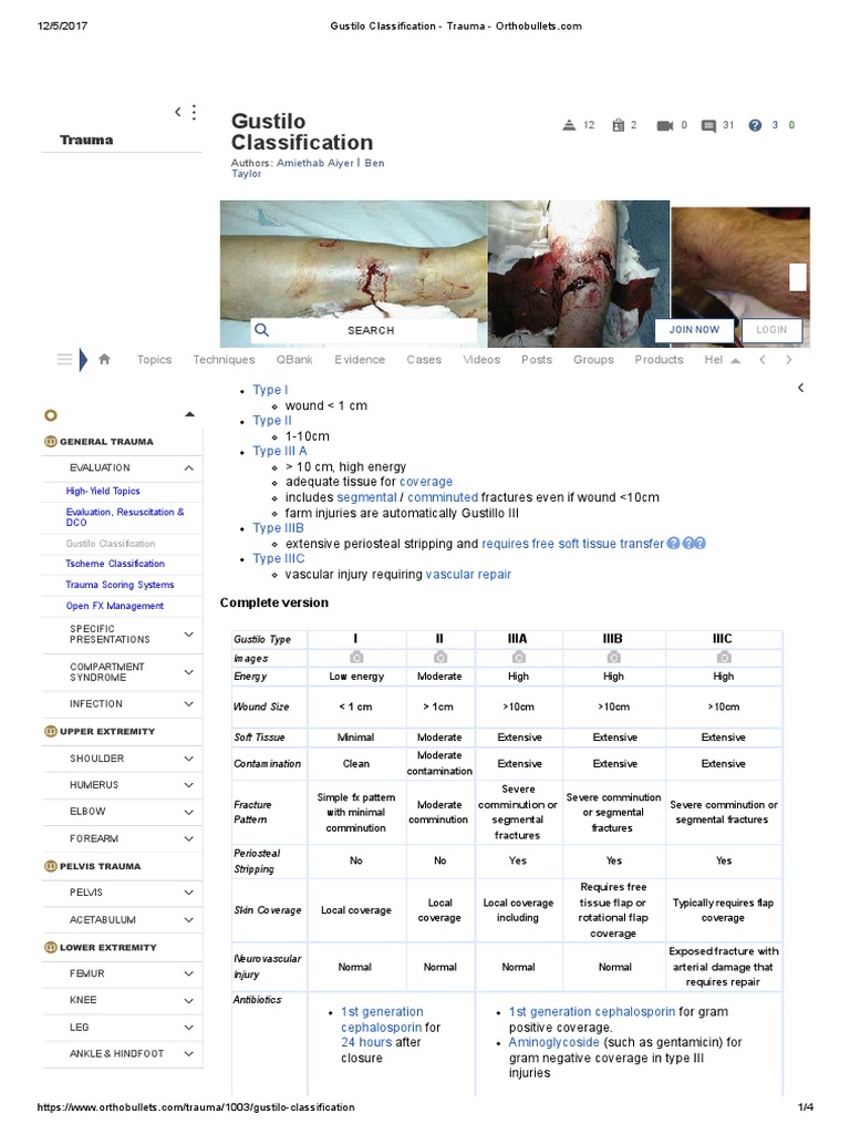 Gustilo Classification - Trauma - Orthobullets | Trauma Grave | Ferimento