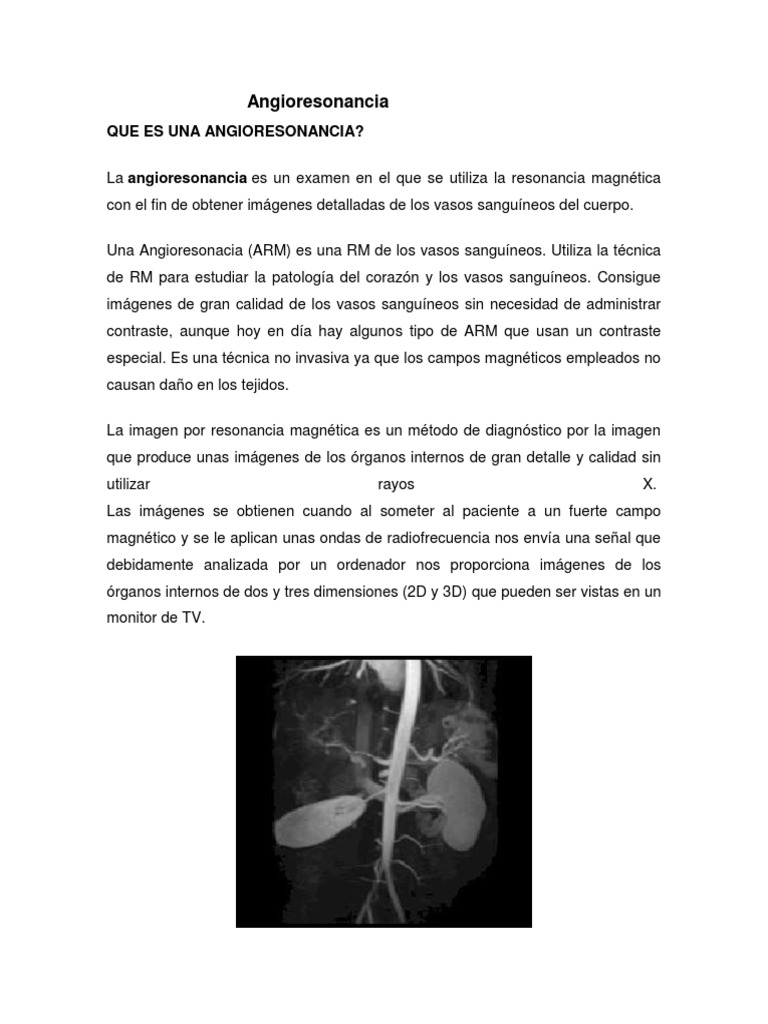 Angioresonancia IMAGEN | PDF | Angiografía | Imagen de resonancia magnética