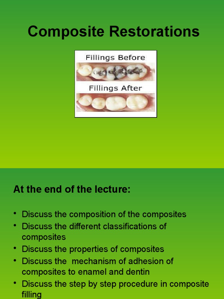 Overview of Composite Restorations | PDF | Dental Composite | Composite ...