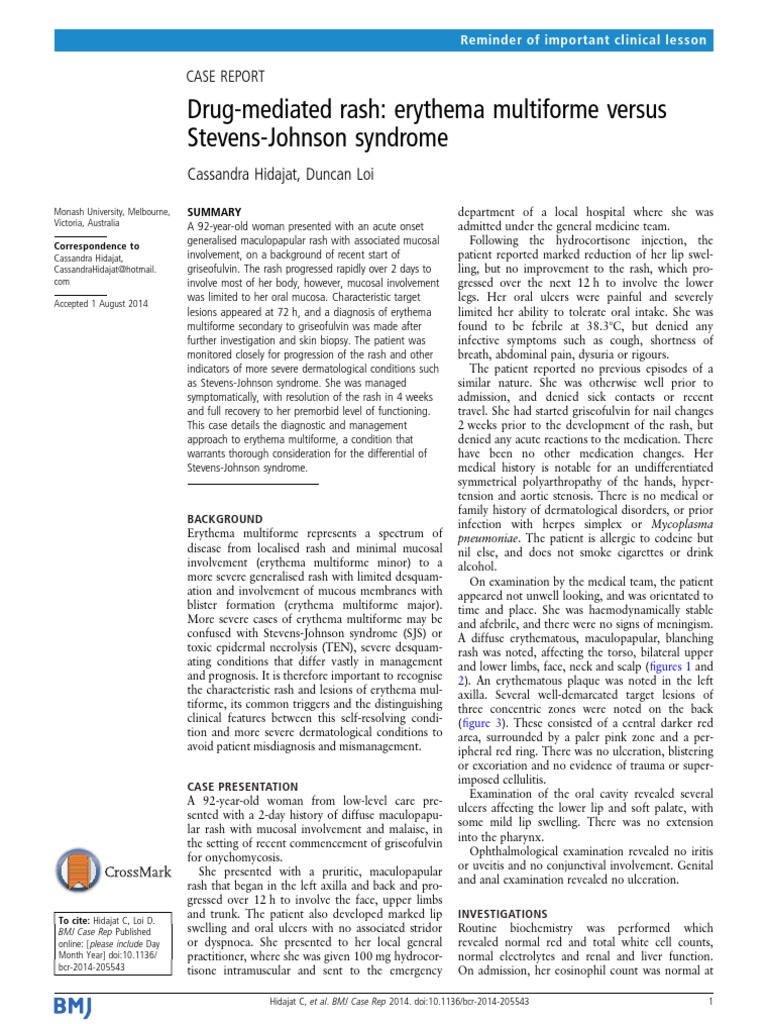 Drug Mediated Rash Erythema Multiforme Versus Stevens Johnson Syndrome