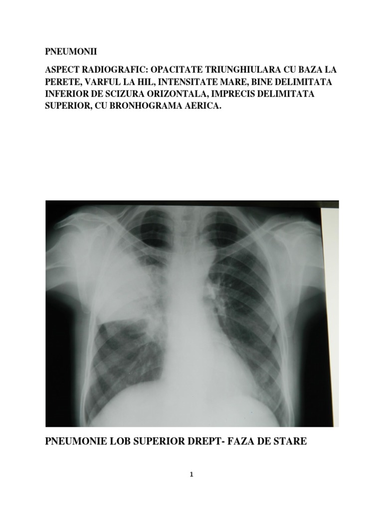 RX Studenti Plaman | PDF