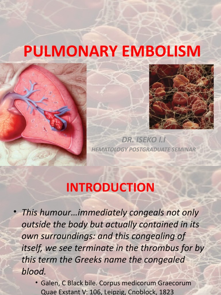 Pulmonary Embolism | PDF | Cardiovascular System | Thrombosis