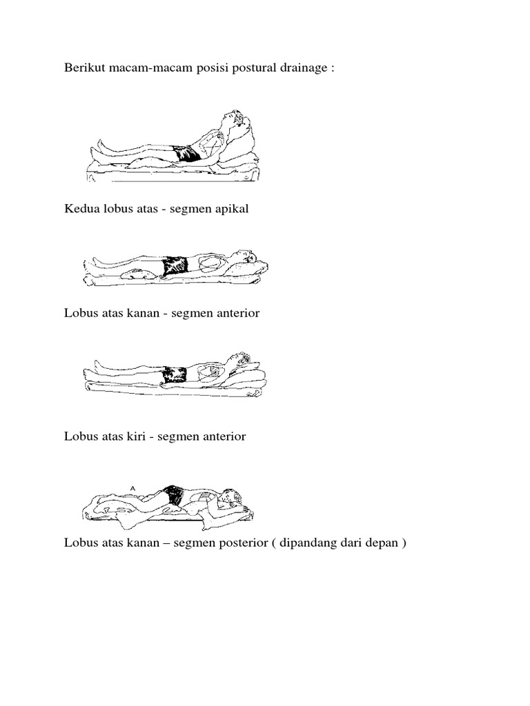 Posisi Postural Drainase Paru | PDF