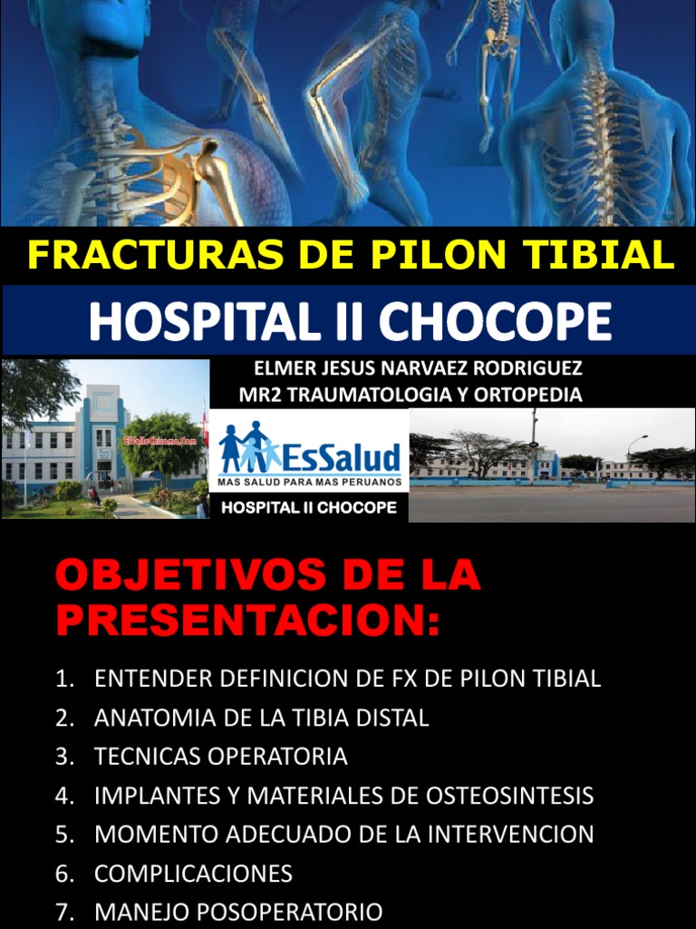Fracturas de Pilón Tibial: Clasificación y Manejo | PDF | Medicina ...