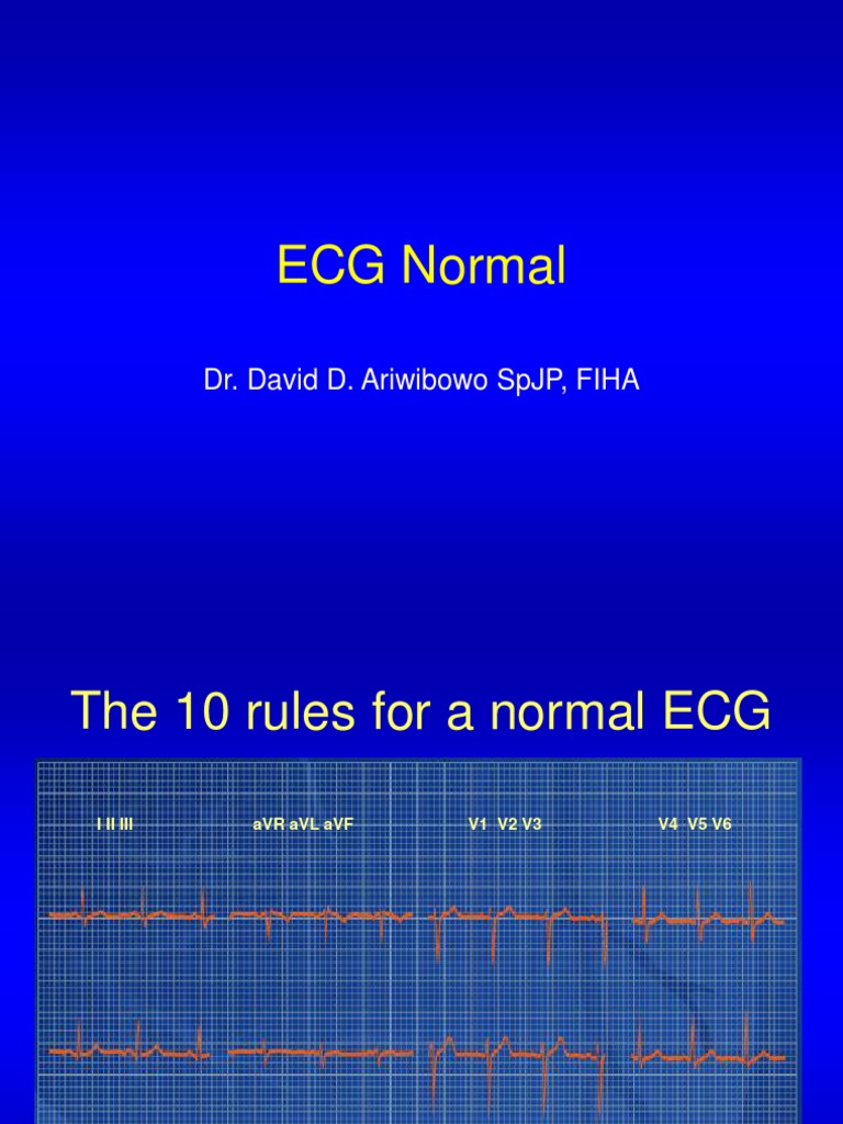 10 Rules for a Normal ECG | PDF | Electrocardiography | Visual Cortex