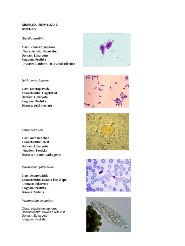 Giardia Lamblia: Murillo, Emmylou S. Bsmt-3D | PDF
