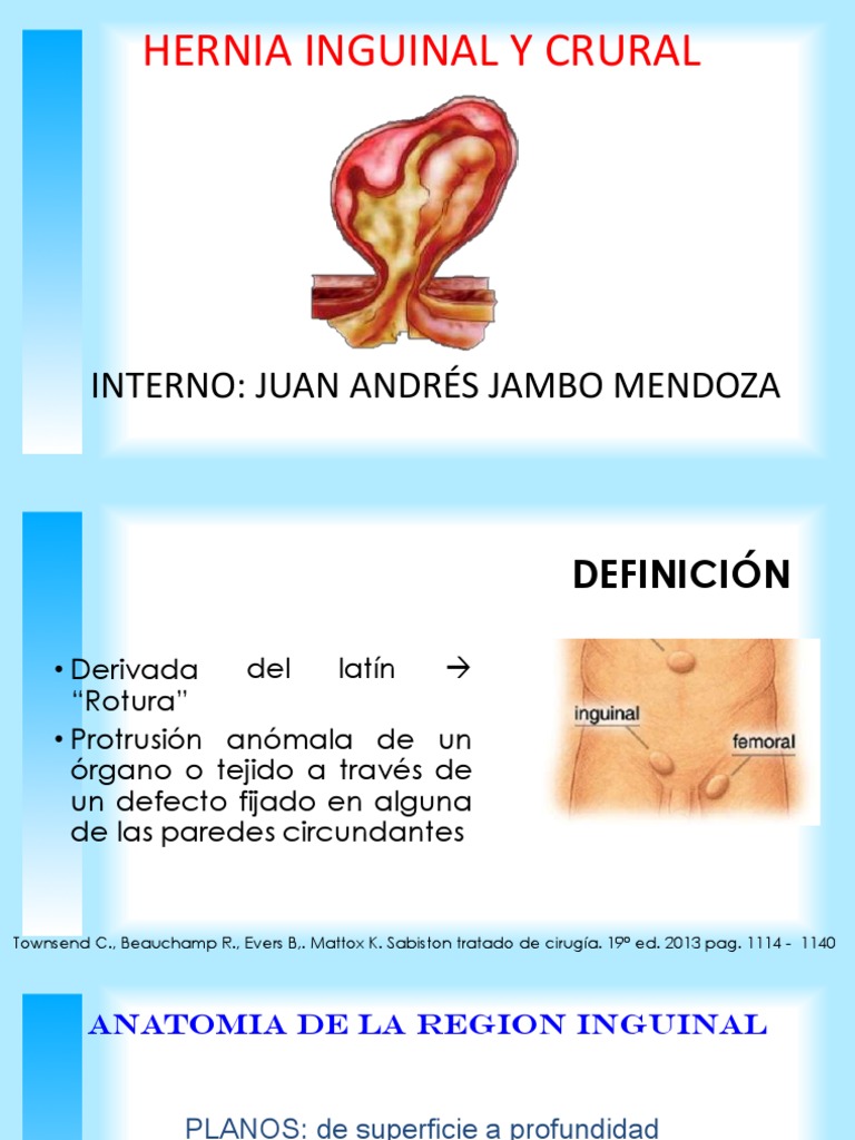 Expo Final Hernia Inguinal y Crural | PDF | Abdomen | Medicina CLINICA