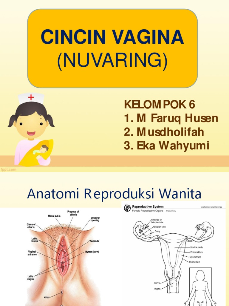 NUVARING