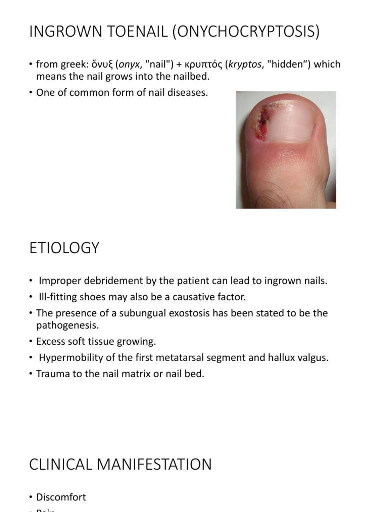 Ingrown Toenail (Onychocryptosis) | PDF | Medical Specialties | Health ...