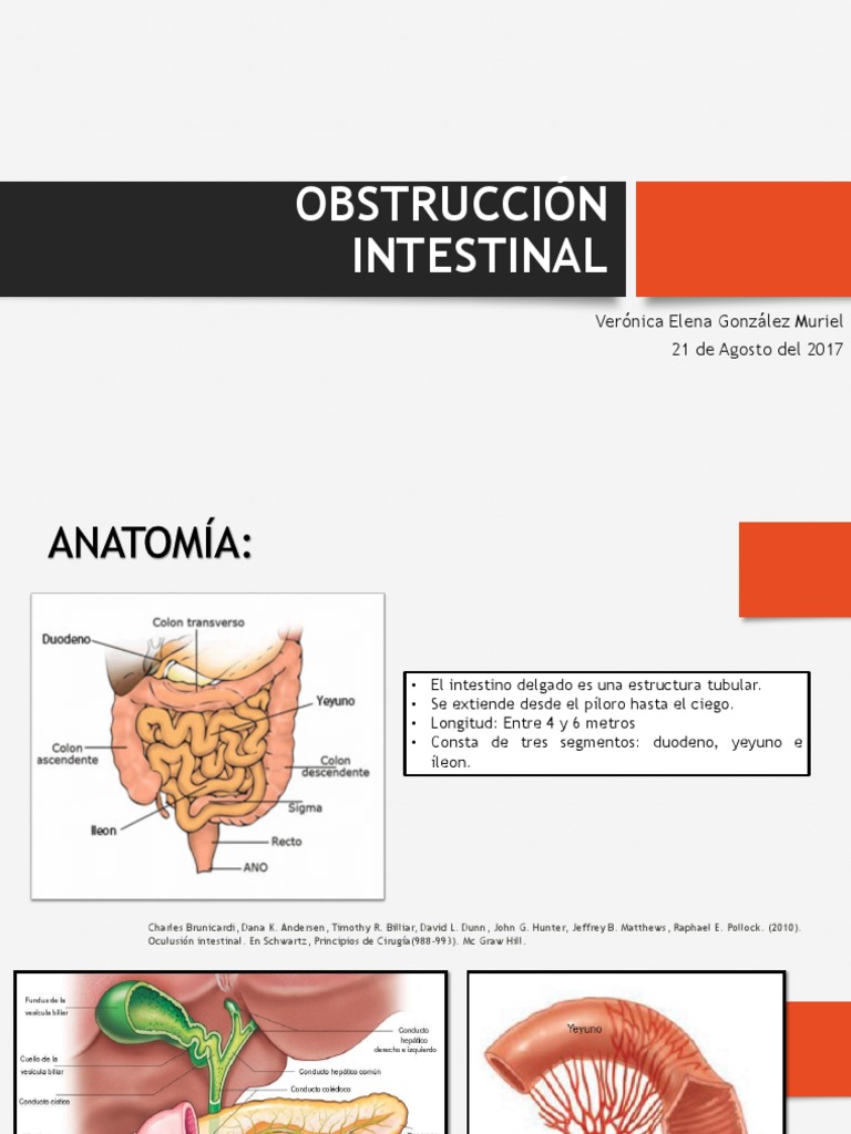 Obstrucción Intestinal | PDF | Intestino delgado | Medicina CLINICA