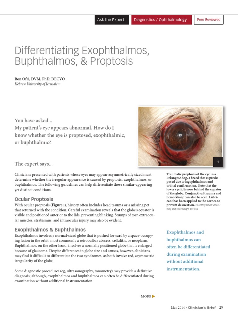 Differentiating Exophthalmos Buphthalmos Proptosis | Glaucoma | Medical ...