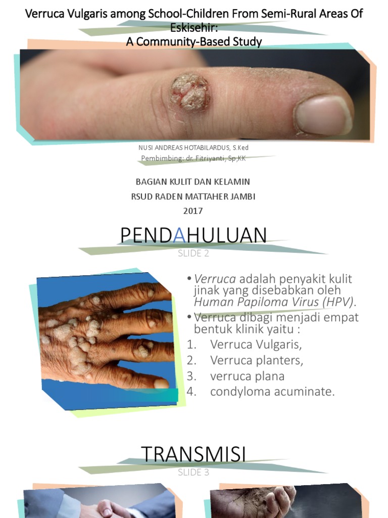 Verruca Vulgaris | PDF