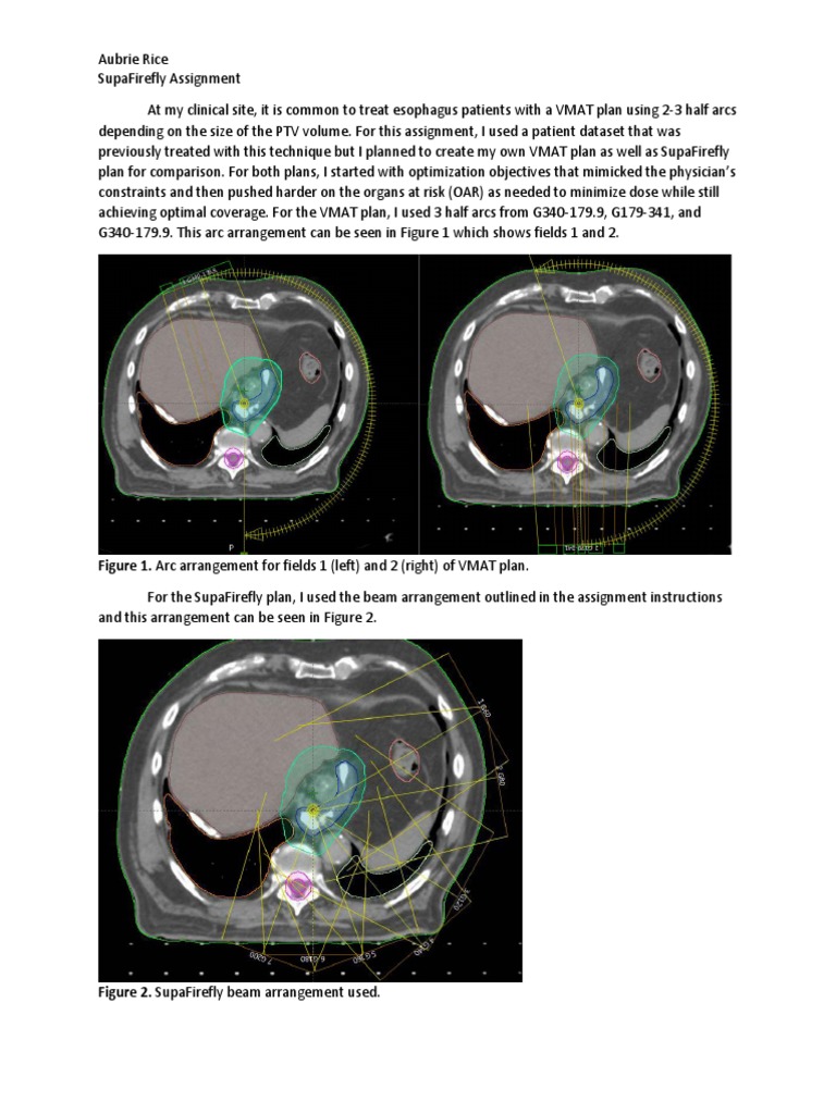 Figure 1. Arc Arrangement For Fields 1 (Left) and 2 (Right) of VMAT ...