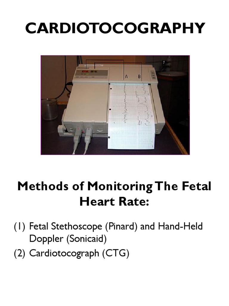 Cardiotocography | PDF | Heart Rate | Heart