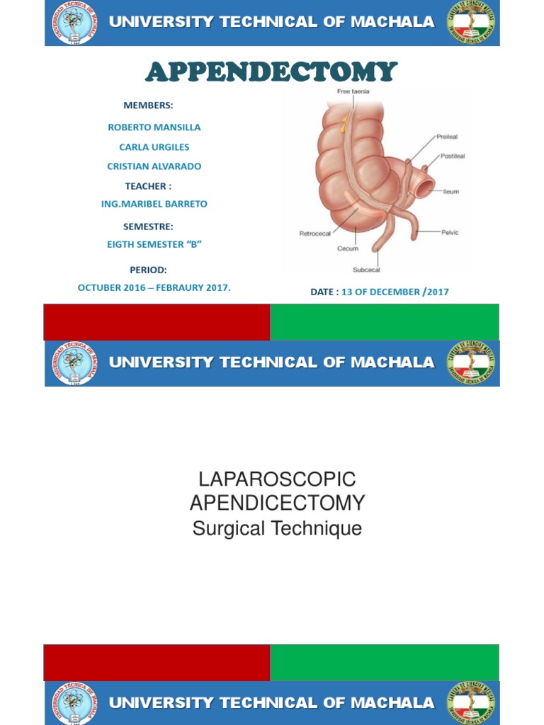 A Technical Report on Laparoscopic Appendectomy Techniques and Anatomy ...