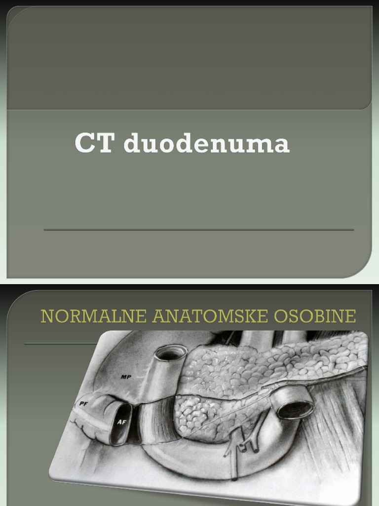 CT Duodenuma Predavanje | PDF