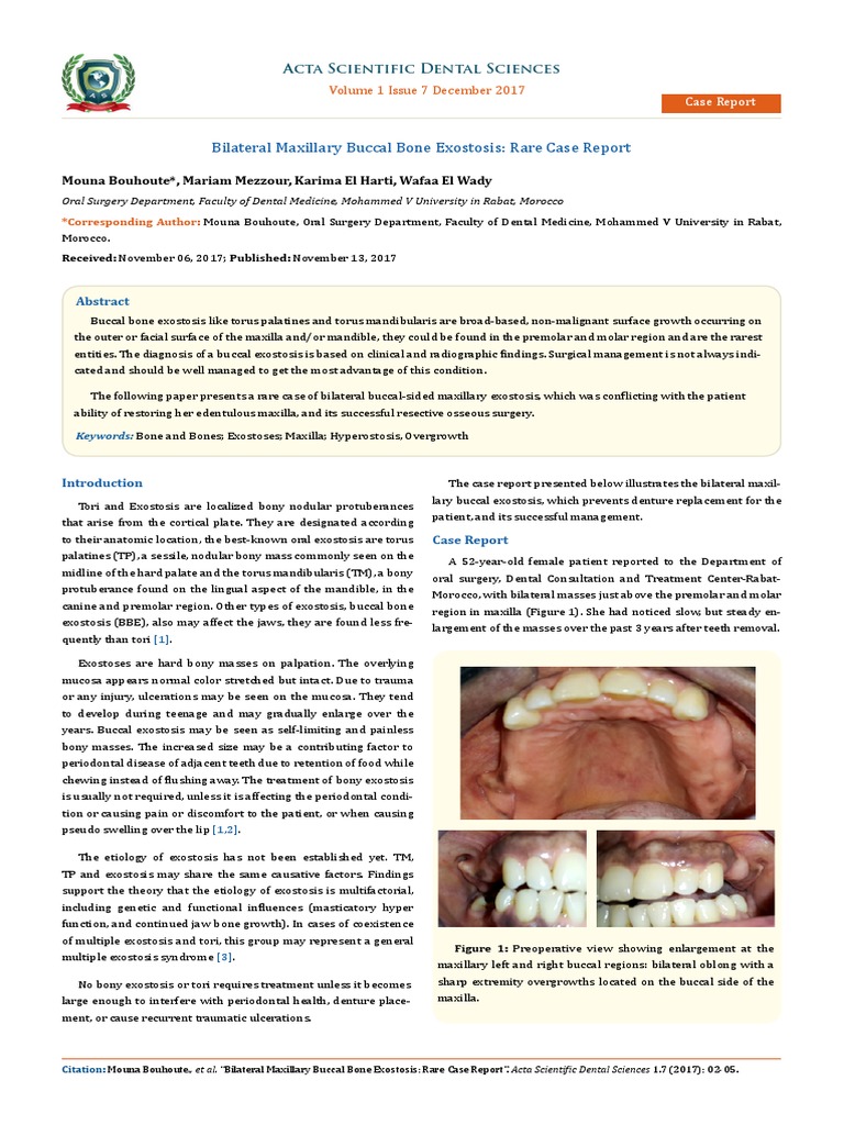 Bilateral Maxillary Buccal Bone Exostosis: Rare Case Report | Download ...