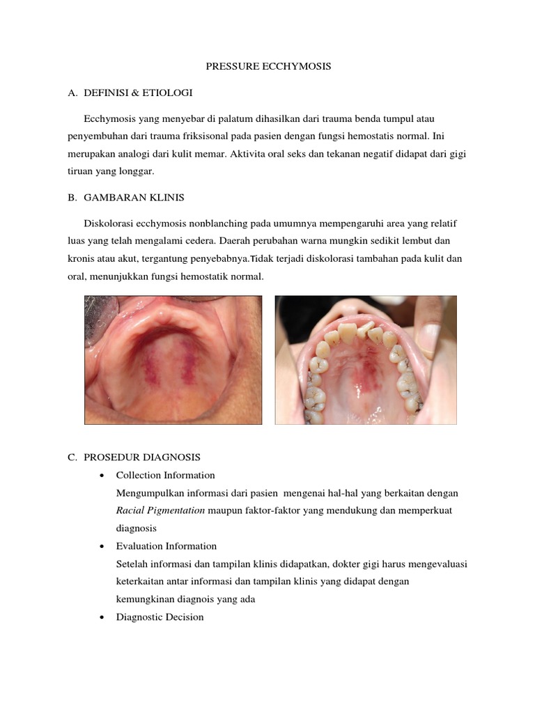 Trauma Palatal Akibat Oral Seks | PDF | Pengembangan Diri | Kesehatan ...