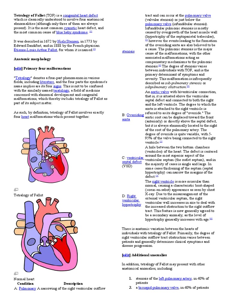 Tetralogy of Fallot | PDF | Congenital Heart Defect | Internal Medicine