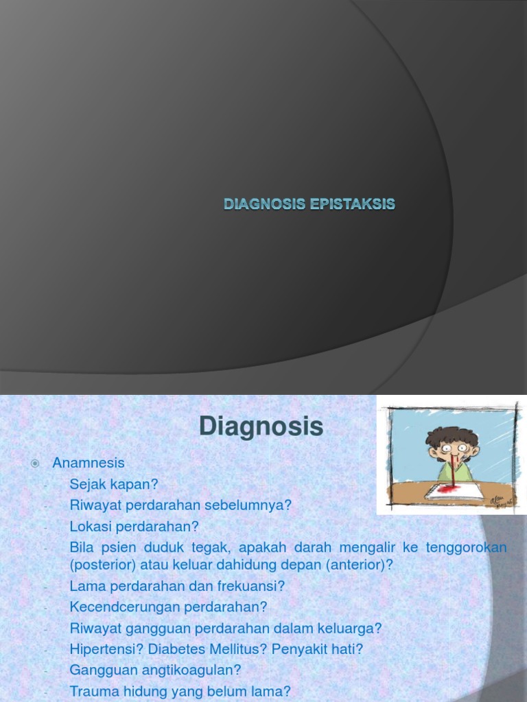 Diagnosis Epistaksis | PDF