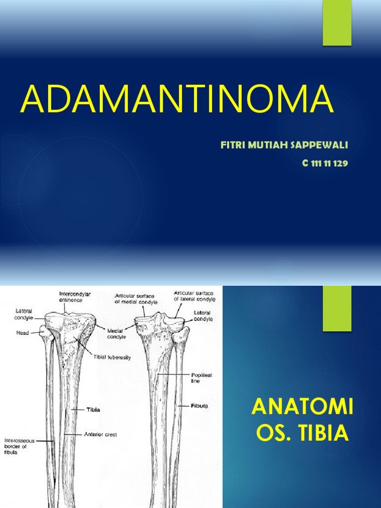 Adamantinoma: Tumor Tulang Langka | PDF