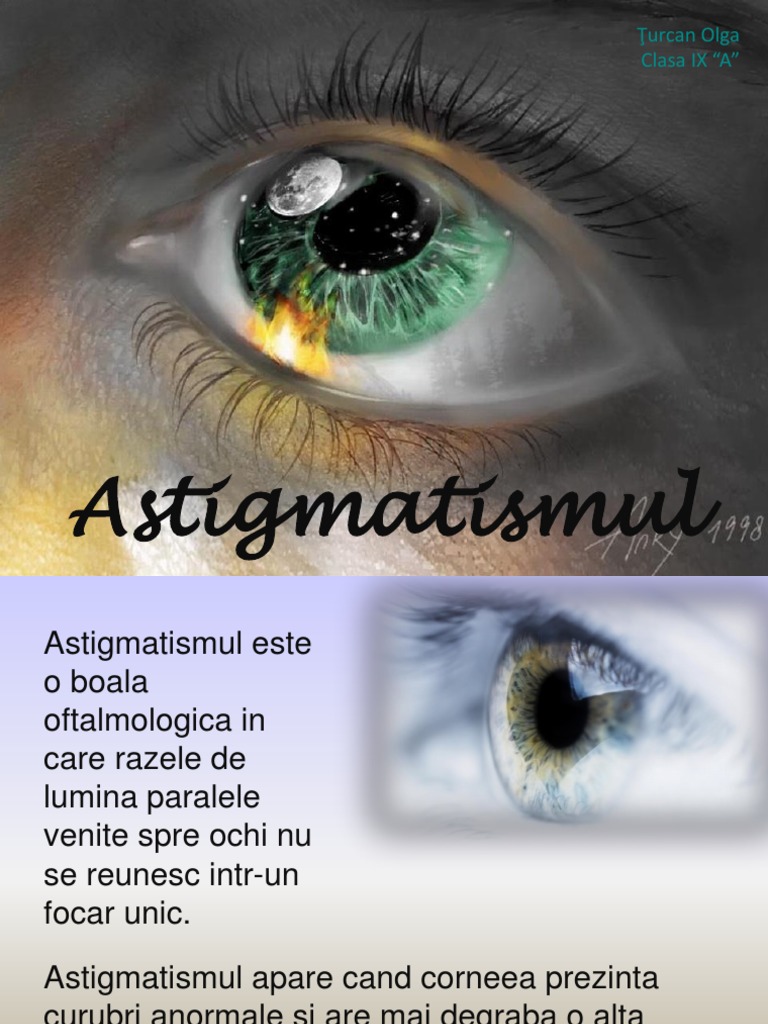 Astigmatismul | PDF