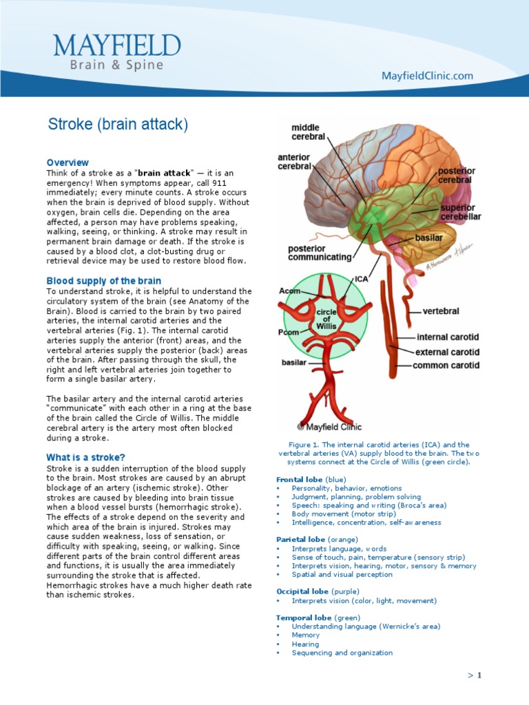 Stroke (Brain Attack) : Frontal Lobe (Blue) | PDF | Angiography | Stroke