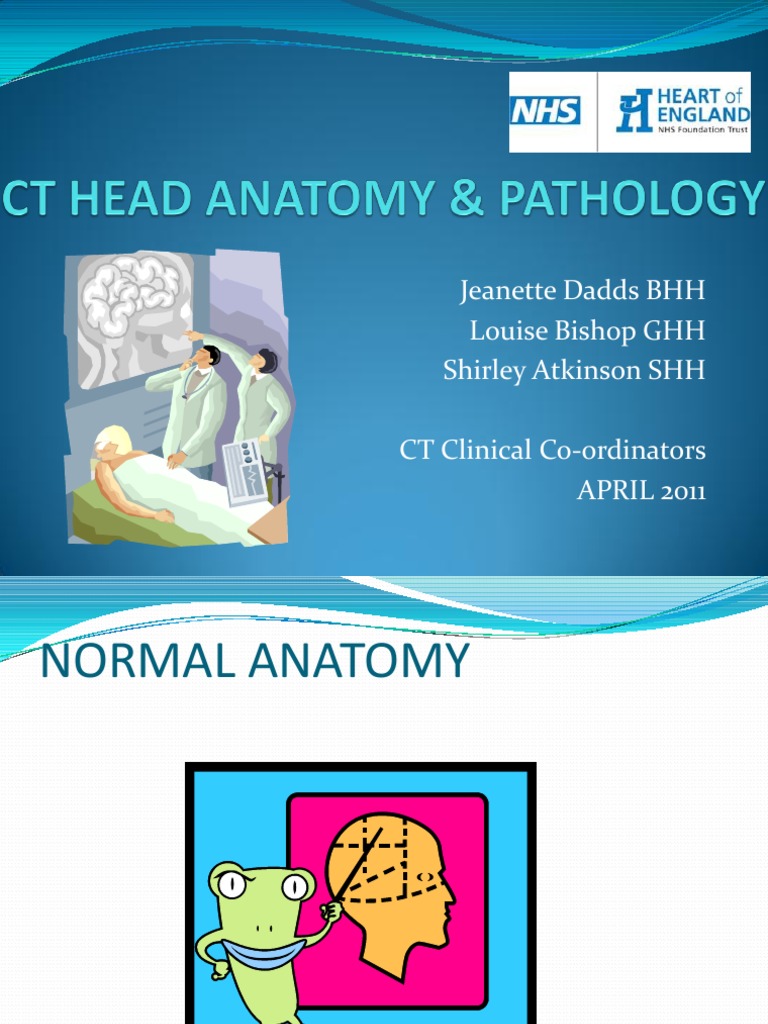 CT Brain Anatomy and Pathology Overview | PDF