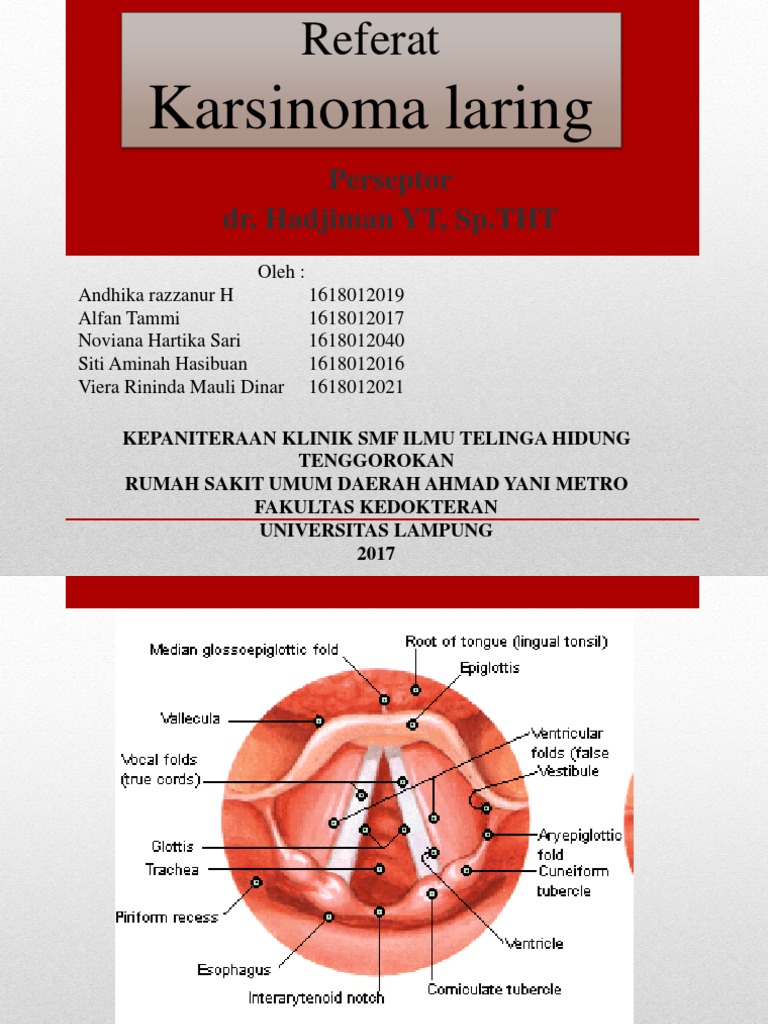 REFERAT Karsinoma-Laring | PDF