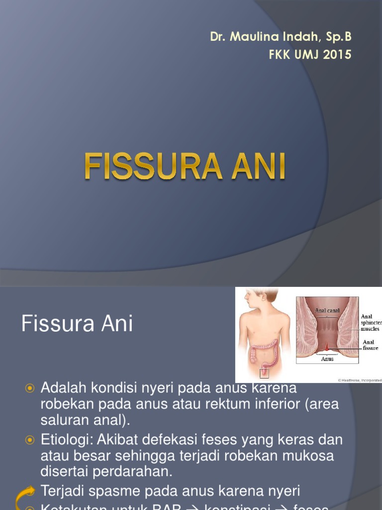 Fissura Ani | PDF