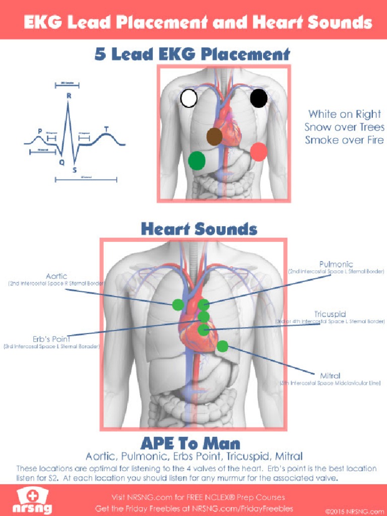 5 Lead Ecg Placement