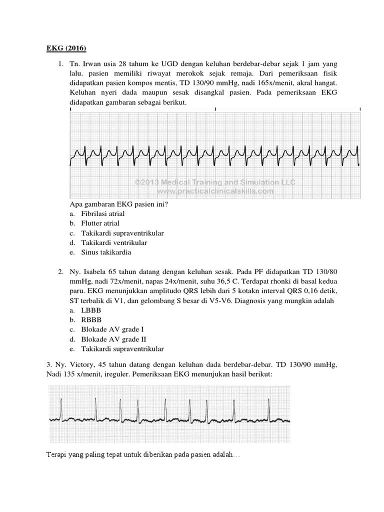 Ekg | PDF