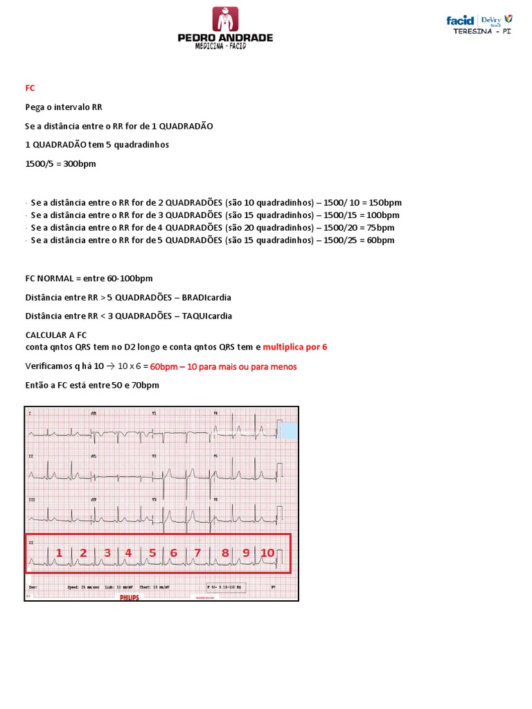 Ecg - Principais Ritmos | PDF | Doenças cardiovasculares | Angiologia