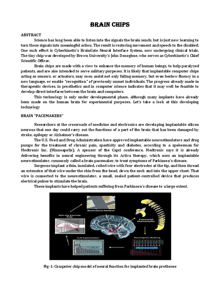 Brain Chips | PDF | Brain | Neuroscience