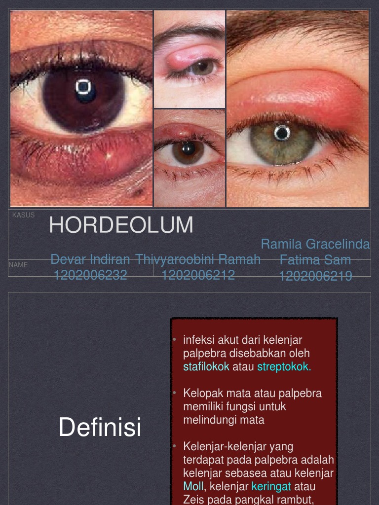 Horde Olum | PDF