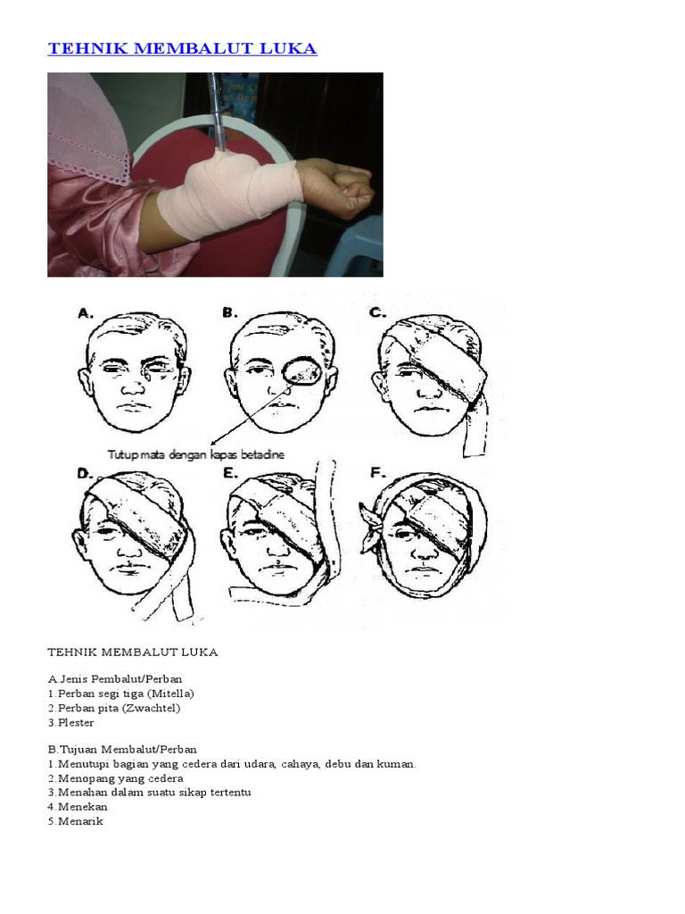 Teknik Pembalutan Luka dan Perban | PDF