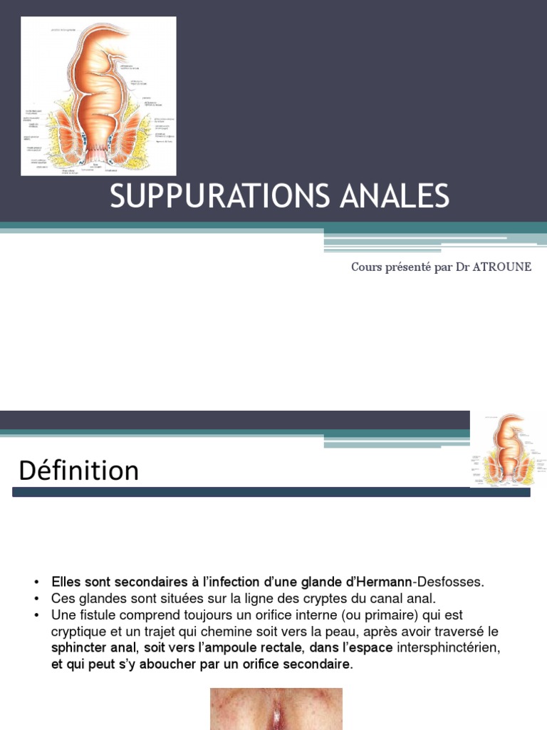 Suppurations et Fistules Anales | PDF | RTT | Médecine