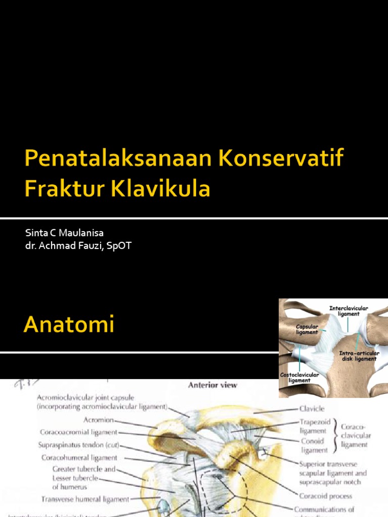 Fraktur Klavikula | PDF